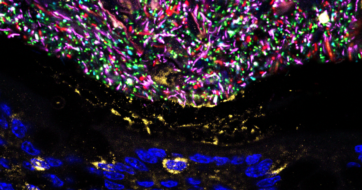 DCVC | The Engineered Patient