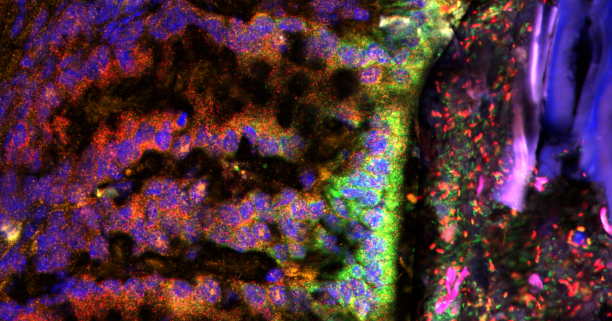 DCVC | DCVC leads $12M financing for Kanvas Biosciences to map the…