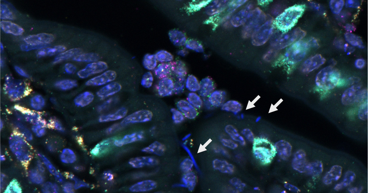 DCVC | With Assets from Federation Bio, Kanvas Aims to Replace…