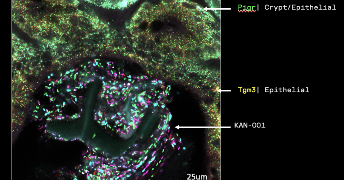 DCVC | DCVC co-leads $12.5 million financing for Kanvas Biosciences…