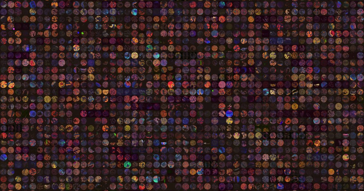 DCVC | How Noetik uses images to give its AI model a deeper…